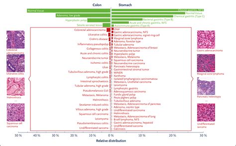 Pathway Model Of Ia Program A A The Highlighted Pink Line Ukraine In