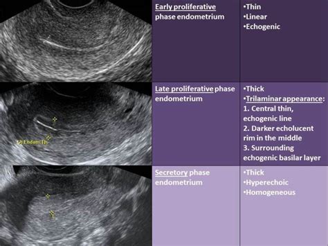 The Normal Menstrual Cycle And The Control Of Ovulation Artofit
