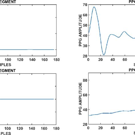 Examples Of Bad Ppg Segments That Were Screened And Discarded During