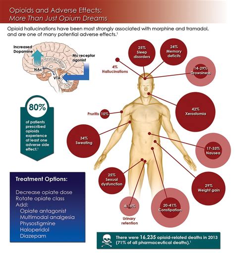 Opium Drug Side Effects Opium Wikipedia