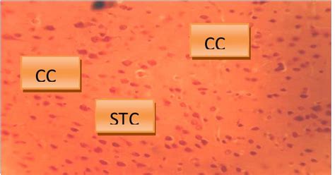 Plate5 Transverse Section Of Cerebral Cortex Of Group 5