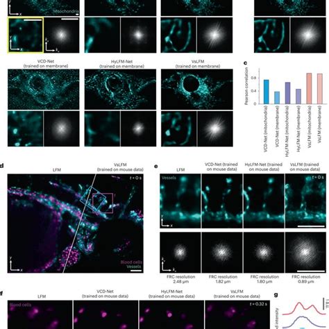 Pdf Virtual Scanning Light Field Microscopy For Robust Snapshot High Resolution Volumetric Imaging
