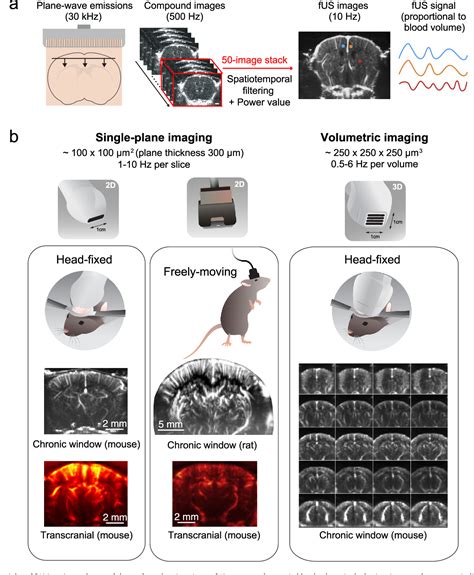 Figure 1 From Functional Ultrasound Imaging A Useful Tool For Functional Connectomics