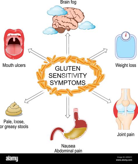 Gluten Sensitivity Symptoms Gluten Intolerance Celiac Disease