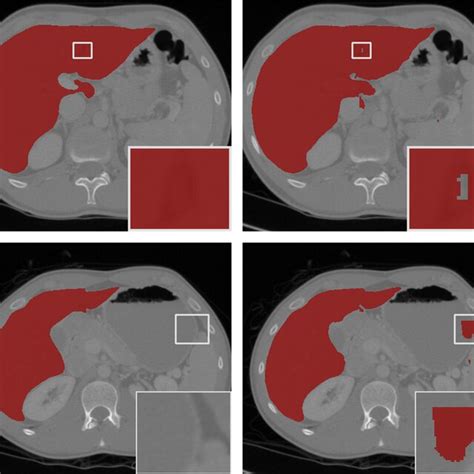 The Segmentation Results With Post Processing From Left To Right The