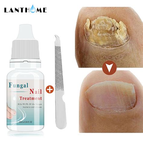 Lanthome Nail Repair Essence Serum Fungal Nail Treatment Anti Fungal