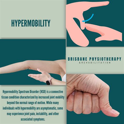 Hypermobility Syndrome Hsd Beighton Score Diagnosis And Physio