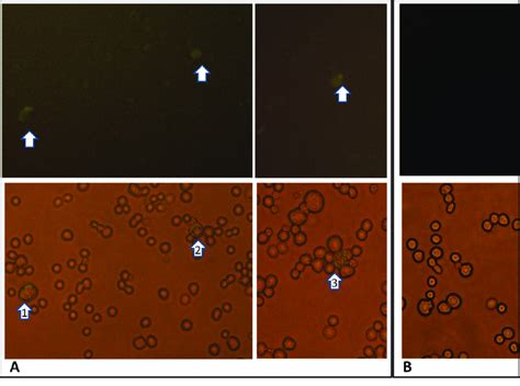 Observation Of Egfp By Fluorescence Microscopy A Third Passage Of