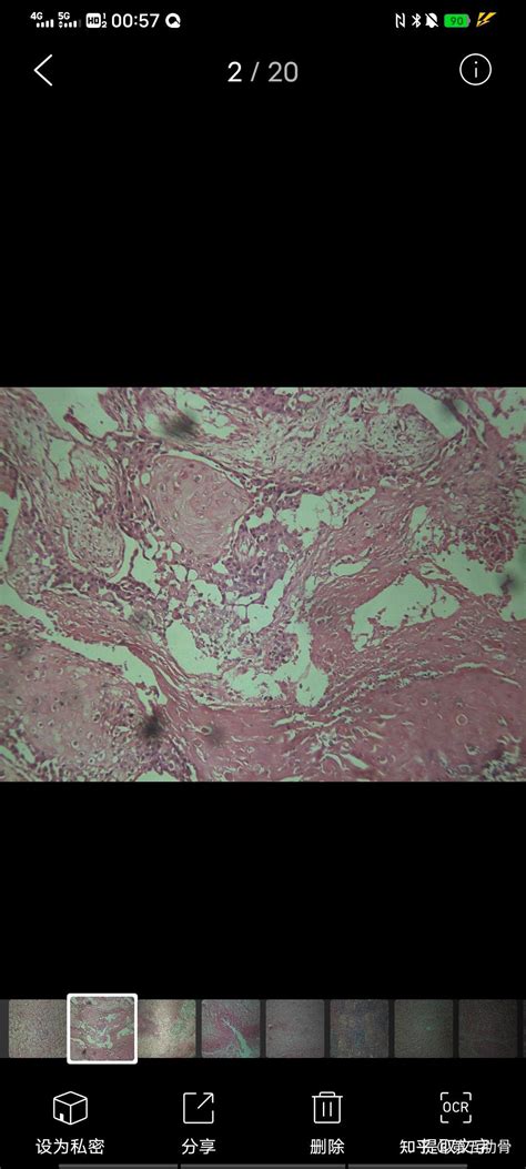 病理学切片 知乎