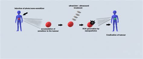 The Schematic View Of Photodynamic Therapy Pdt And Sonodynamic