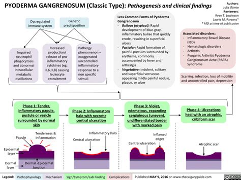 Pyoderma Gangrenosum Pathogenesis And Clinical Findings Calgary Guidecalgary Guide