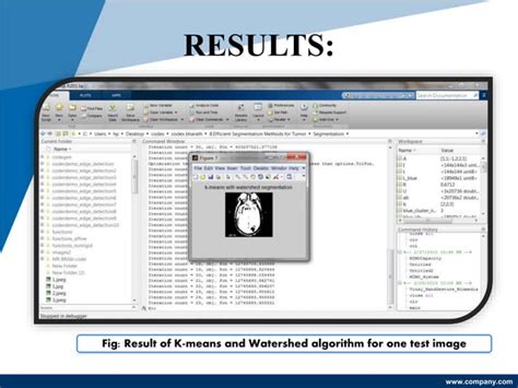 Ppt On Brain Tumor Detection In Mri Images Based On Image Segmentation