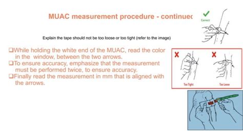 Simplified Approaches For Managment Of Sam 2 Pptx
