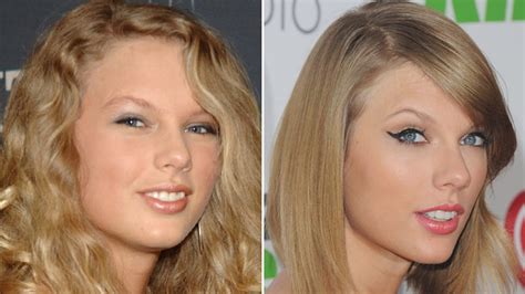 Taylor Swift Good Genes Or Good Docs