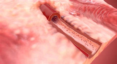 Page 3 200 Constricted Pictures