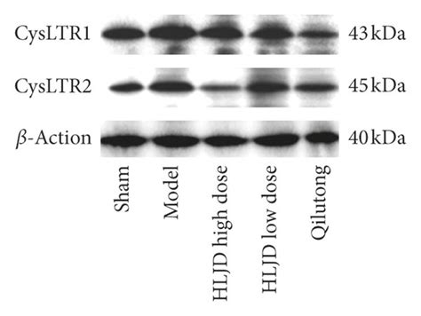 Protein Levels Of Cd11b And Cd206 Were Tested Through Western Blot