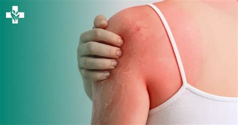 Doxycycline For Uti Treatment