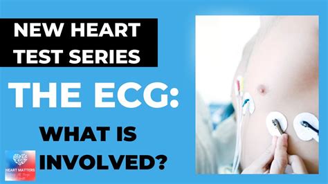 The Electrocardiogram Ecg Ekg