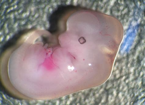 Fanos Mcb Blog Mouse Embryo Anatomy
