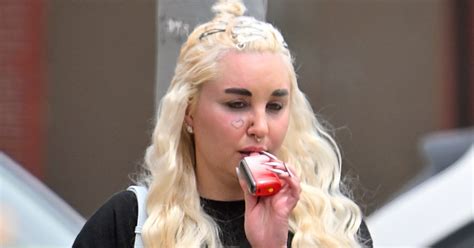 Amanda Bynes Before And After What Happened To Her Face Mandatory