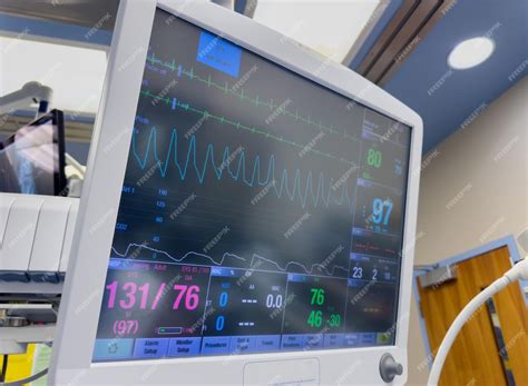 O Monitor Do Hospital Simboliza O Cuidado Do Paciente Com Sinais Vitais