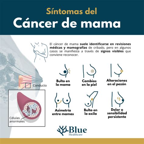 Cáncer De Mama Síntomas Señales De Alerta Y Detección