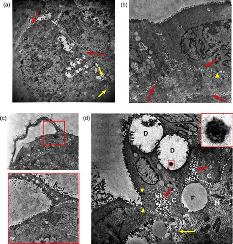 Ultrastructural Evaluation Of Hepatocyte Cholangiocyte Hc Spheroids