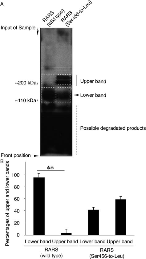 Hypomyelinating Leukodystrophy Associated Mutation Of Rars Leads It To The Lysosome Inhibiting
