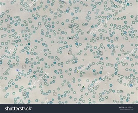Reticulocyte Count Under Microscope 100x Methylene Foto Stock