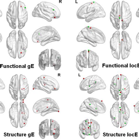 Pdf Aberrant Brain Network Efficiency In Parkinsons Disease Patients With Tremor A Multi