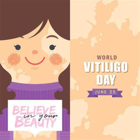 60 Mongoloid Disease Backgrounds Stock Illustrations Royalty Free