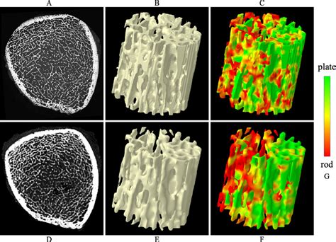 Comparison Of Trabecular Bone Tb Microstructure Using Micro‐ct And Ct