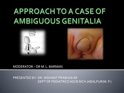 Approach To A Case Of Ambiguous Genitalia Pptx