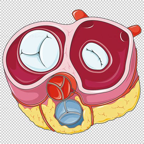 Mitral Valve Stenosis Vector