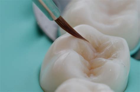 Mastering Posterior Morphology And Composites Aspiredental