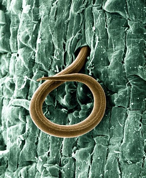 Root Knot Nematode Wikipedia