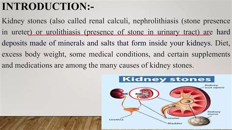 Renal Calculuspptx