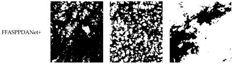 Radiation Feature Fusion Dual Attention Cloud Segmentation Network