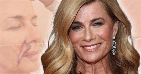 Deborah Hutton On Skin Cancer And Embracing Her Age