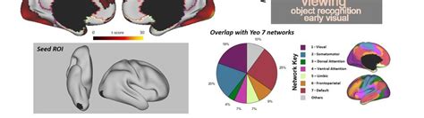 The Functional Network Involving The Region Of Fusiform Cortex Download Scientific Diagram