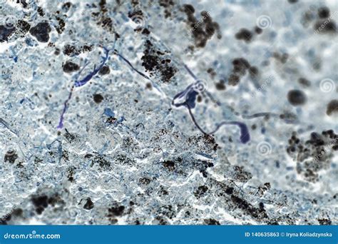 Bacteria Or Cells Under A Microscope Multiplication Of Bacteria Or