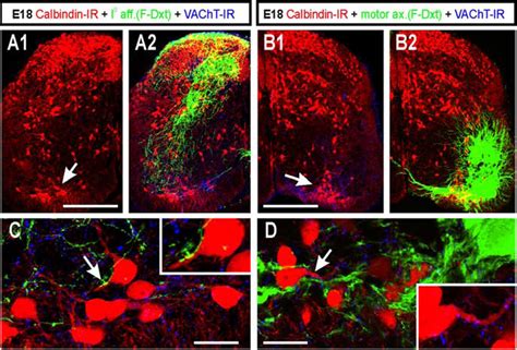 Sensory And Motor Axon Inputs On Embryonic Renshaw Cells Download