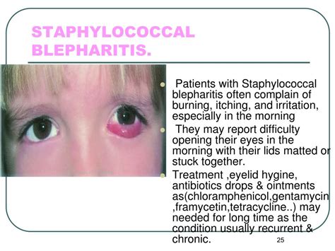 Ppt Eyelids And Lacrimal Apparatus Powerpoint Presentation Free