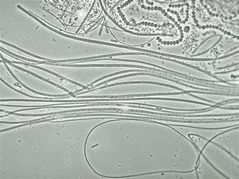 Thiothrix Alchetron The Free Social Encyclopedia