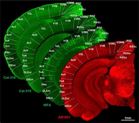 Distribution Of Wfa Ab1031 Cat 315 And Cat 316 Positive Pnns In Download Scientific