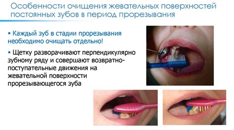 Методы чистки зубов лекция 4 презентация онлайн