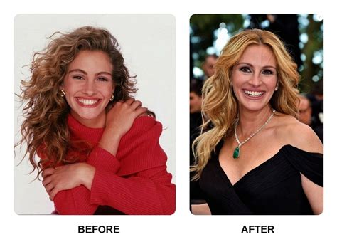 Julia Roberts Teeth The Secret Behind The Million Dollar Smile