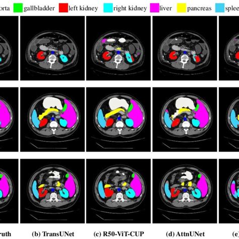 Pdf Transunet Transformers Make Strong Encoders For Medical Image