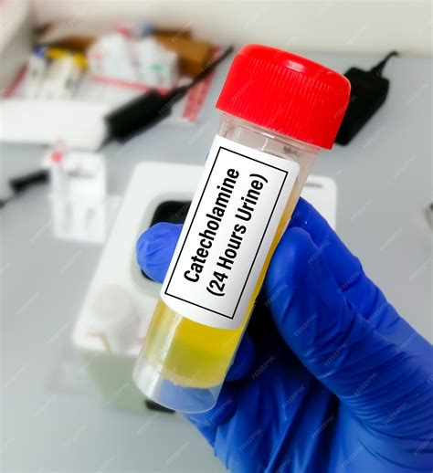Premium Photo Catecholamine 24 Hours Urine Test To Diagnose Adrenal