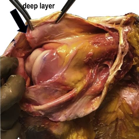 Lateral Trochlear Inclination Angle Trochlear Facet Asymmetry And